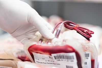 Patient Blood Management Subgroup | The International Society of Blood ...