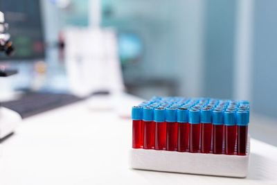 EN 2009 WHO Screening Donated Blood for Transfusion Transmissible ...